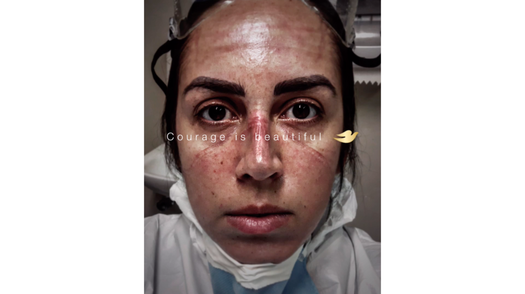 Courage Is Beautiful - UNIT